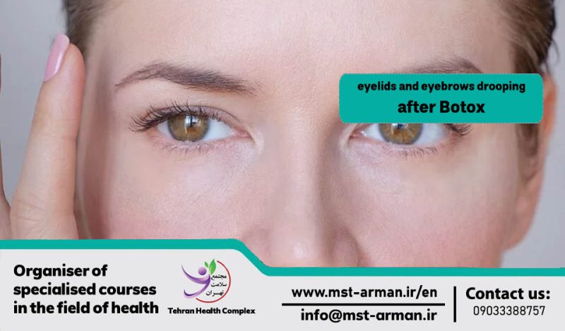 eyelids and eyebrows drooping after botox - MST English Site