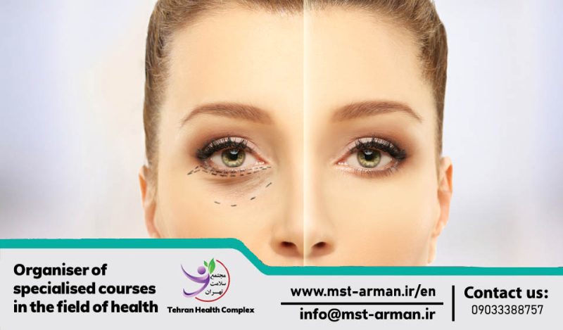 Drooping Eyebrow After Botox Treatment