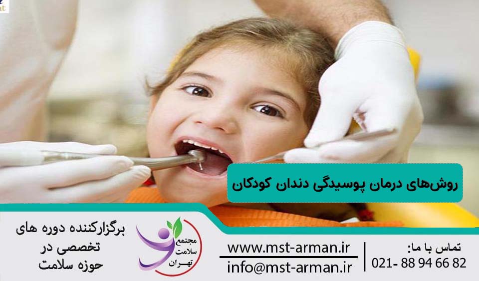 علت‌های پوسیدگی دندان کودکان راه‎های جلوگیری از آن پوسیدگی دندان کودکان